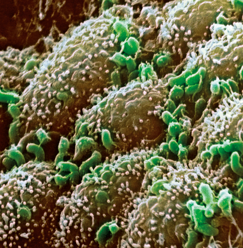 Tarmflora påvirker metabolismen | Tidsskrift for Den norske legeforening